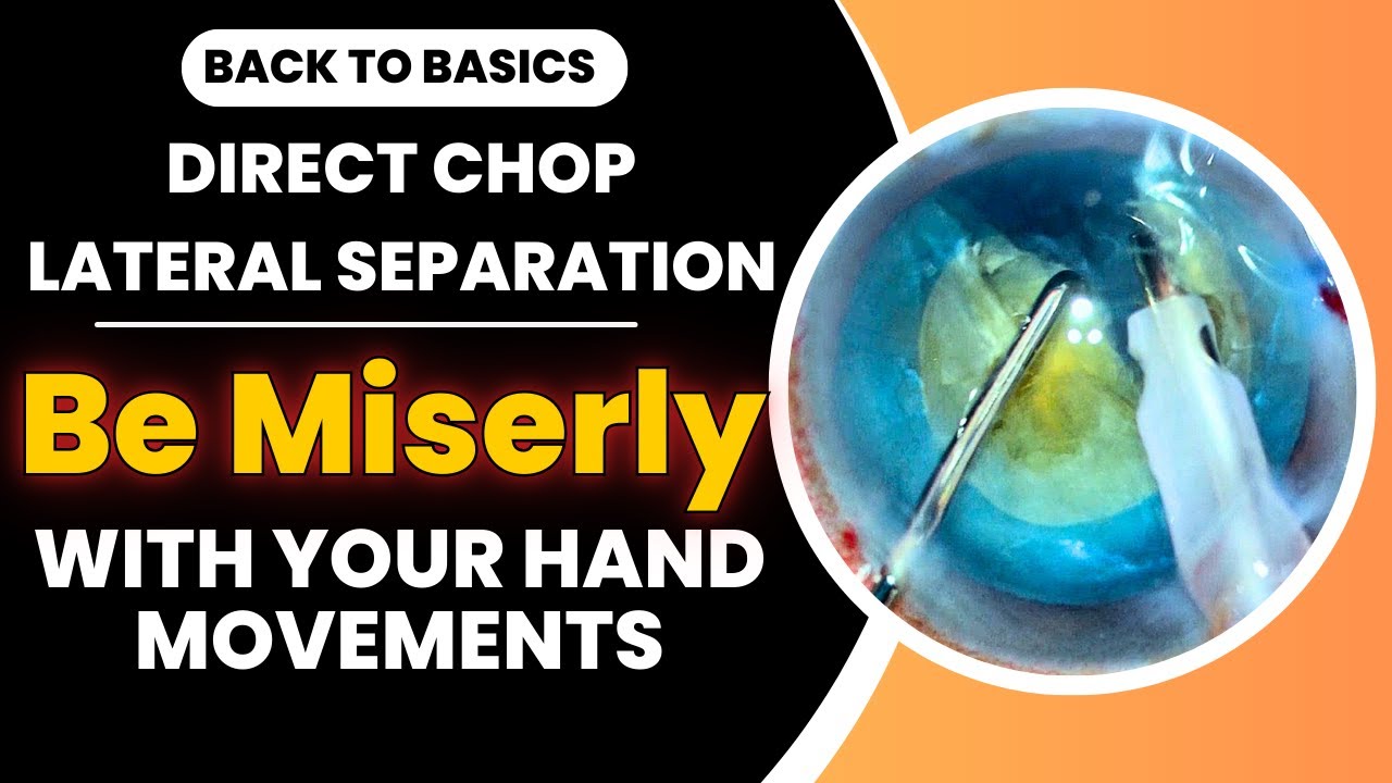 Back to Basics - Direct chop, Lateral separation - Be miserly with your ...