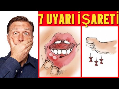 B12 Eksikliğinin 7 UYARI İşareti | Dr. Berg Türkçe