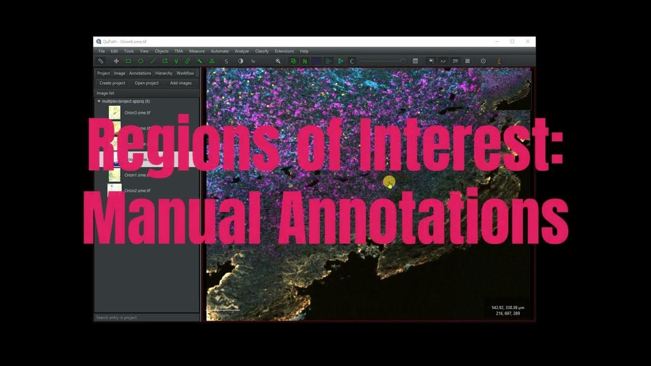 QuPath: ROIs and Manual Annotations - YouTube