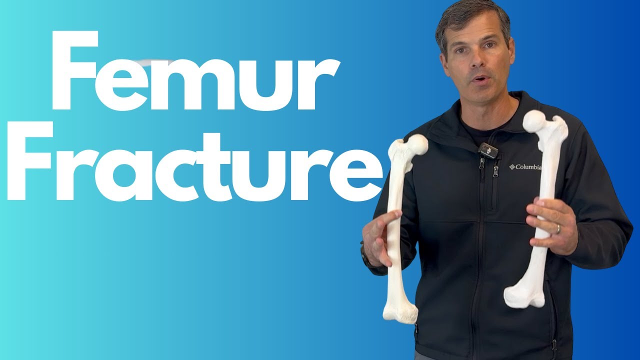 Femur Fracture: Recovery, Training, and Prevention - YouTube