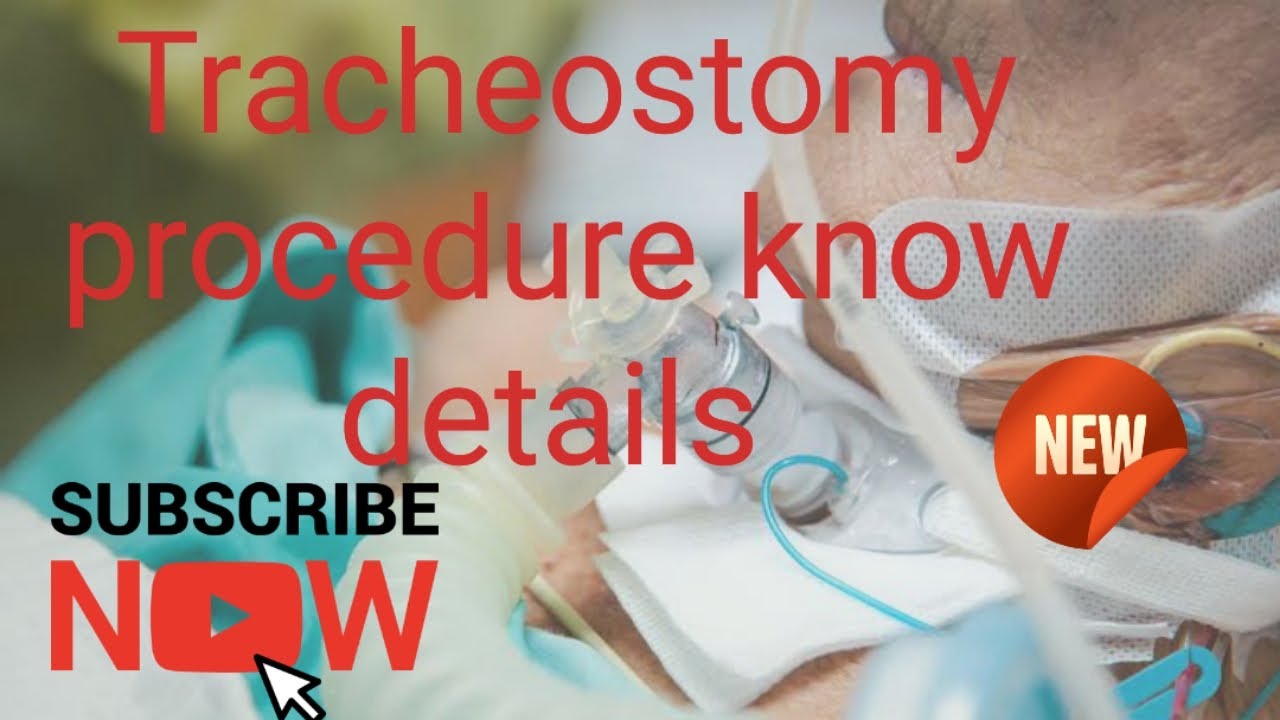 Tracheostomy procedure || know details || Icu procedure || Surgical ...