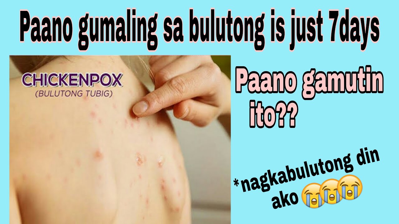 PAANO GUMALING ANG BULUTONG IN JUST 7days?*paano ito gamutin|MITCH ...