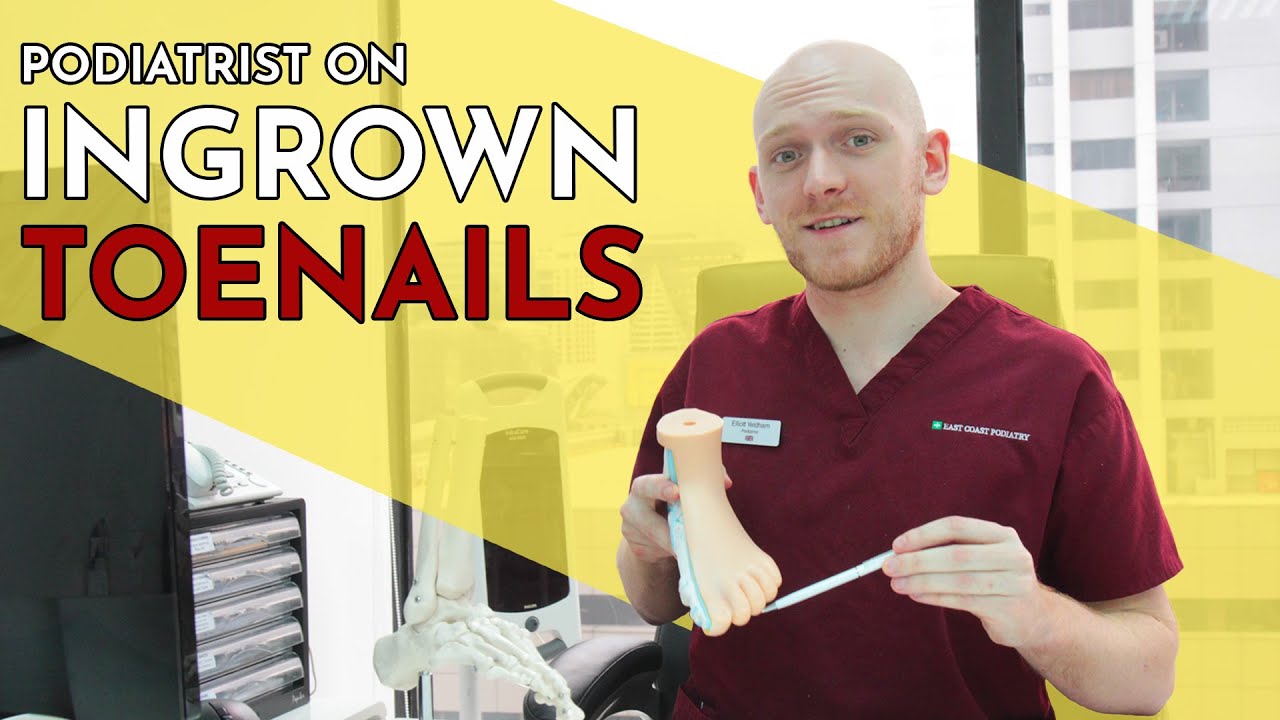 Ingrown Toenails Explained - Senior Podiatrist Elliott Yeldham, East ...