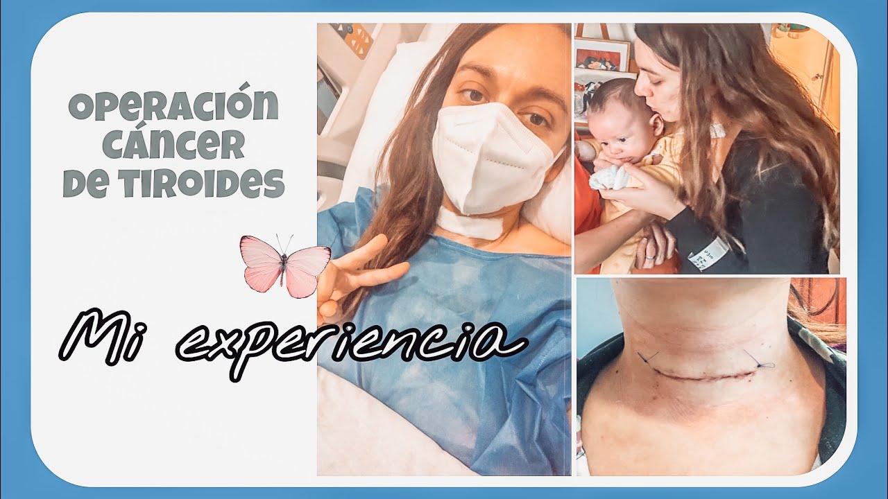 Operación de Tiroides - Nódulo cancerígeno 🦋 mi experiencia || Steph ...