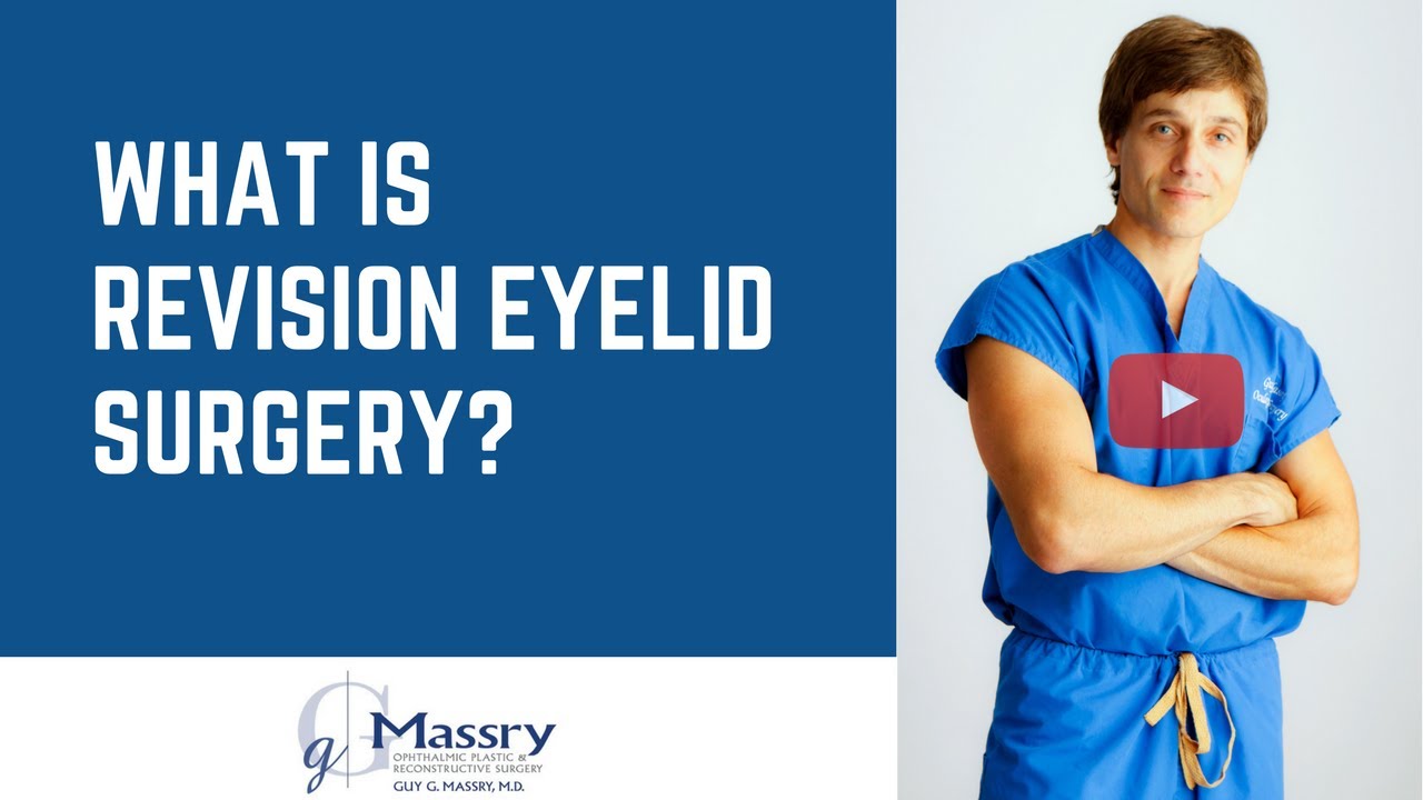 Revision Eyelid Surgery | Fixing Results From Prior Surgeries - YouTube