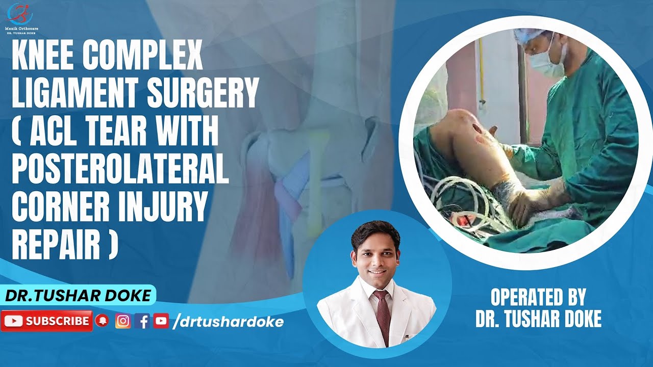 Knee Complex Ligament Surgery ( ACL TEAR WITH POSTEROLATERAL CORNER ...