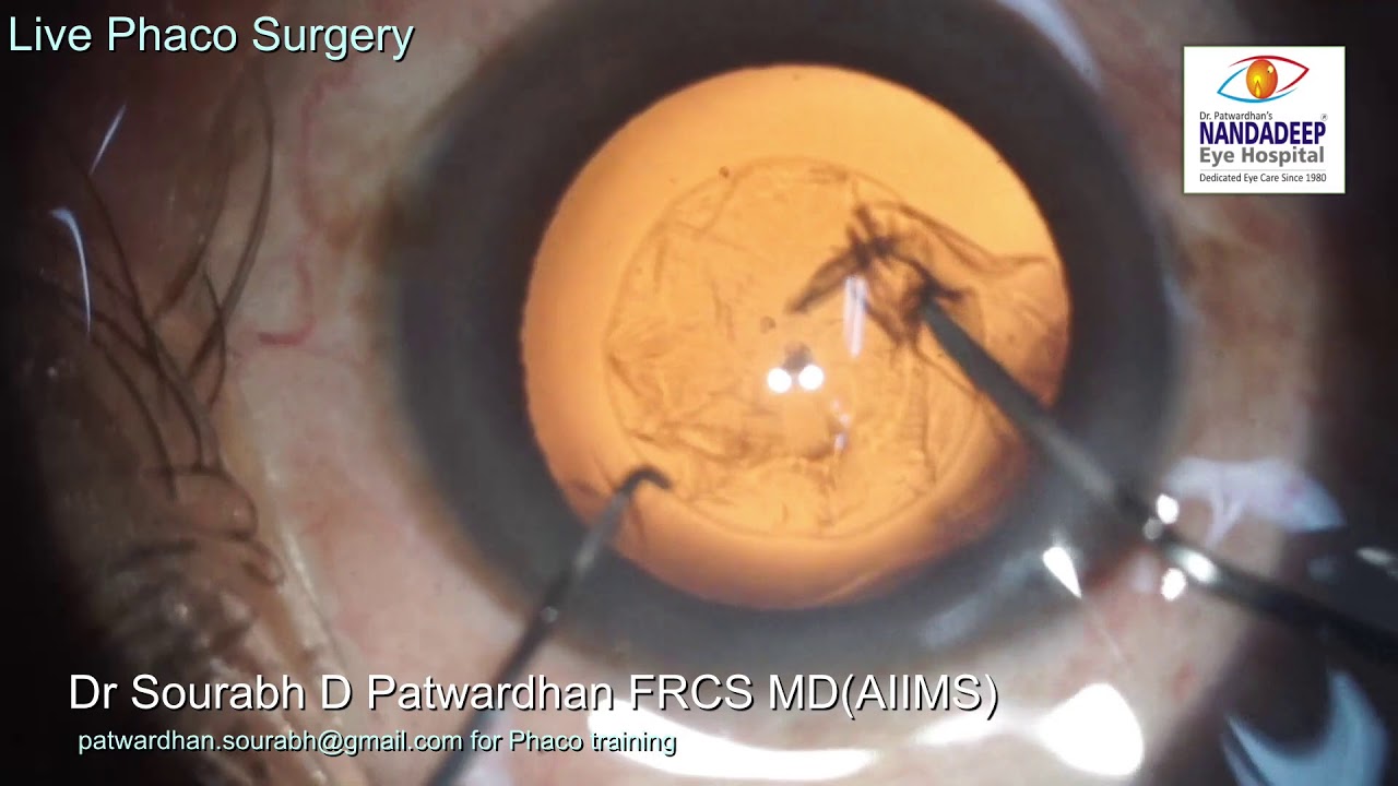 Dr. Sourabh Patwardhan - YouTube