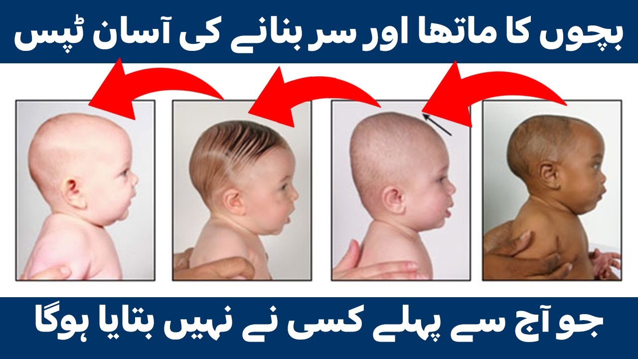 Baby Head Shape Correction Secrets for Perfect Results | Avoid These ...