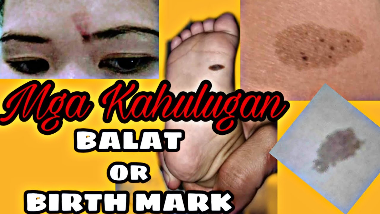 Mga Kahulugan Ng BALAT or BIRTH MARK... - YouTube