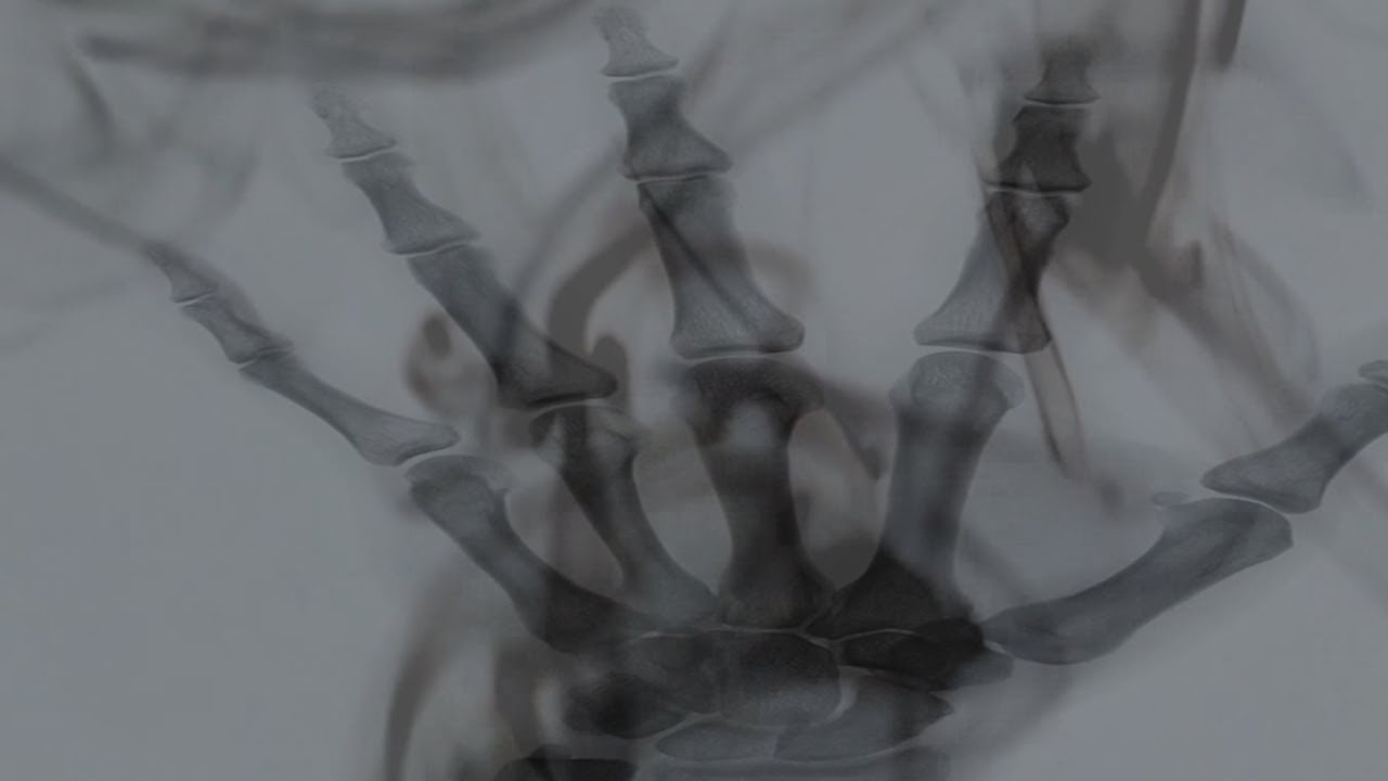 Hand X-ray Double Exposure (Visual Effects) - YouTube