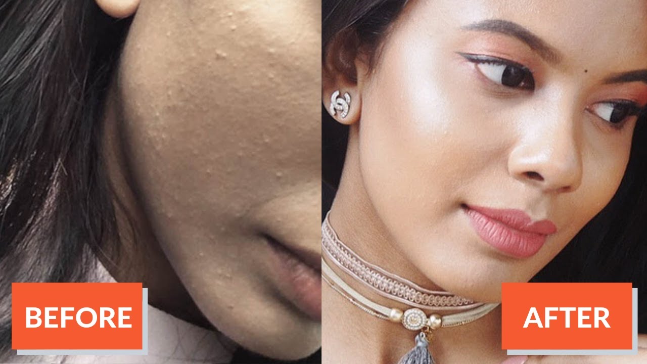 Clearly Basics Review - Improving Skin Texture - Sensitive Skin - YouTube