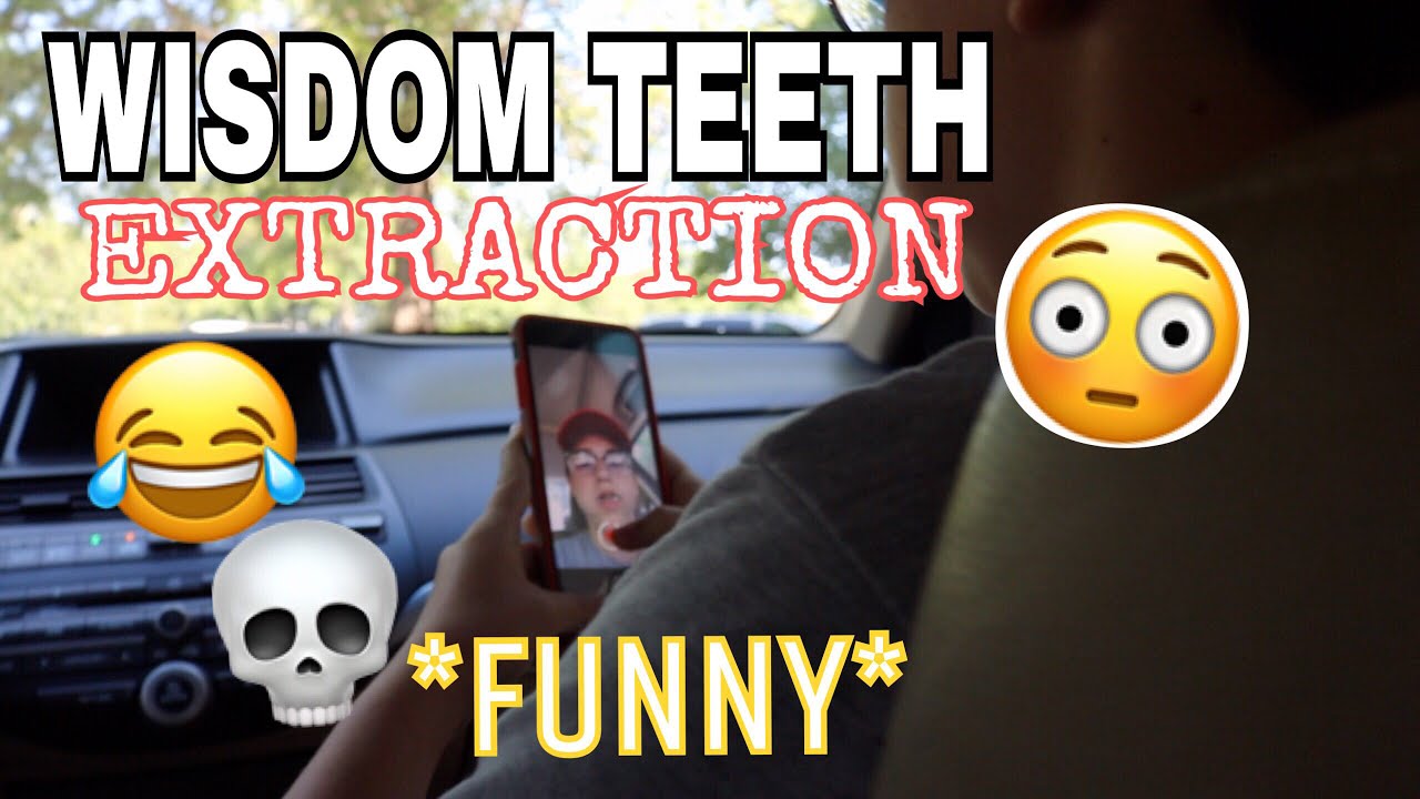 WISDOM TEETH REMOVAL! *HILARIOUS* - YouTube