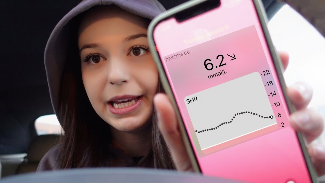 I FINALLY HAVE A DEXCOM - YouTube