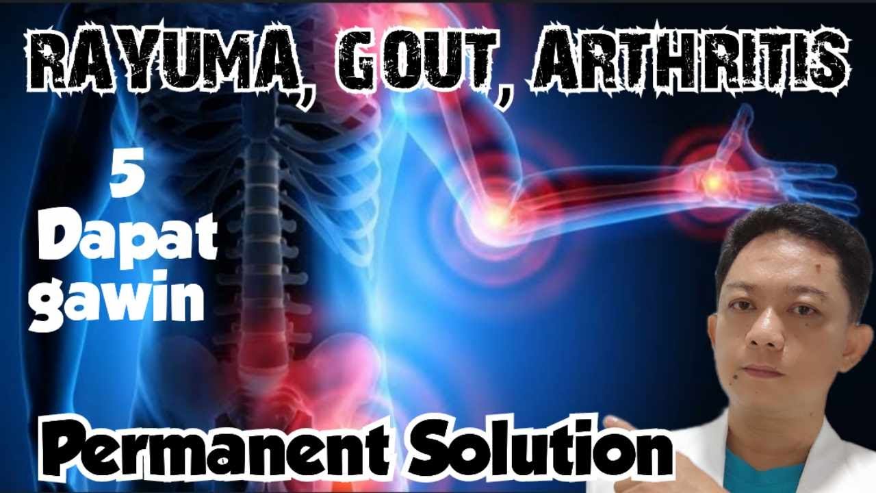 RAYUMA,GOUT ARTHRITIS,5 DAPAT GAWIN, PERMANENT SOLUTION - YouTube