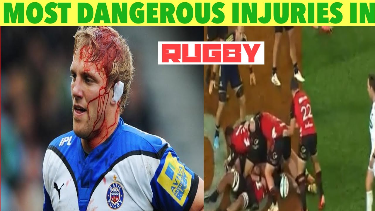 DANGEROUS INJURIES IN RUGBY - YouTube