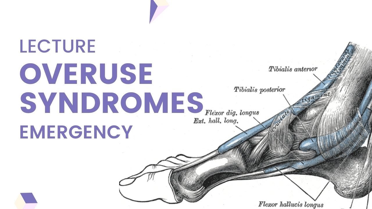 Overuse Syndrome - Detailed explanation - YouTube