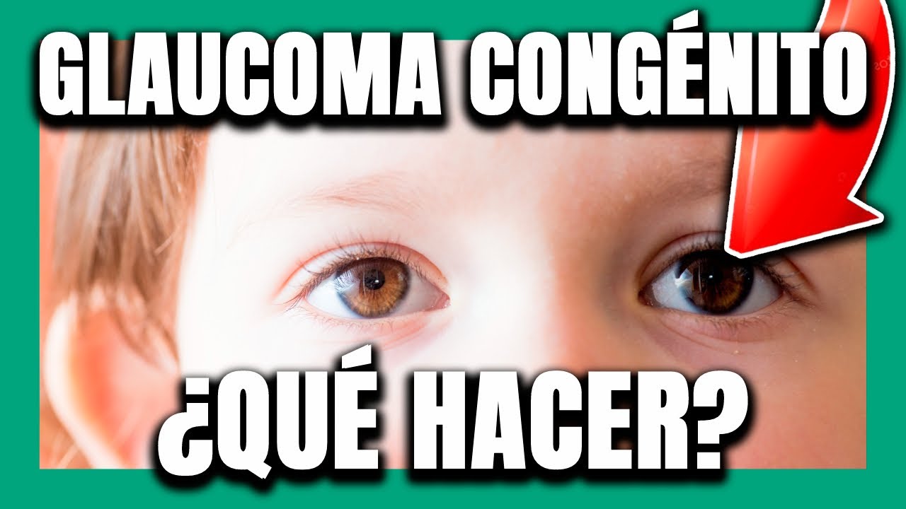 🟢 ¿Cirugía en GLAUCOMA CONGÉNITO? ¿Se cura? #6 - YouTube
