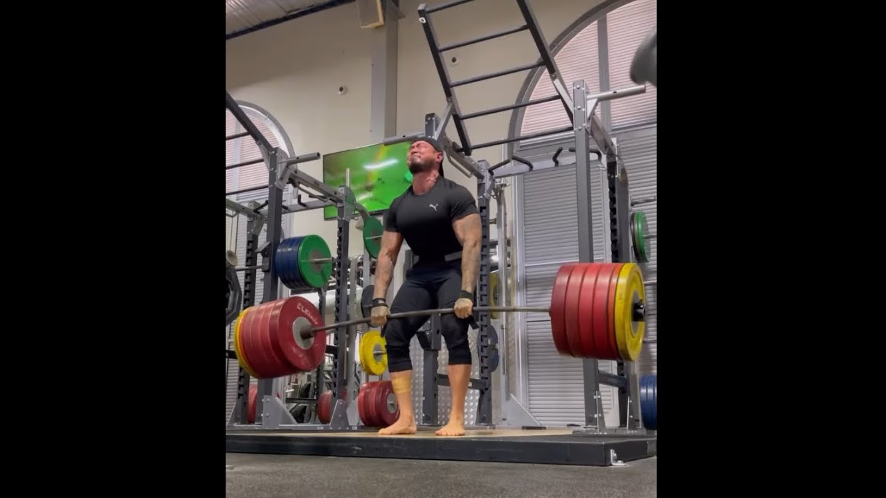 Bilateral Quad Tendon Tear Patella Rupture Recovery - 660 lbs Deadlift ...