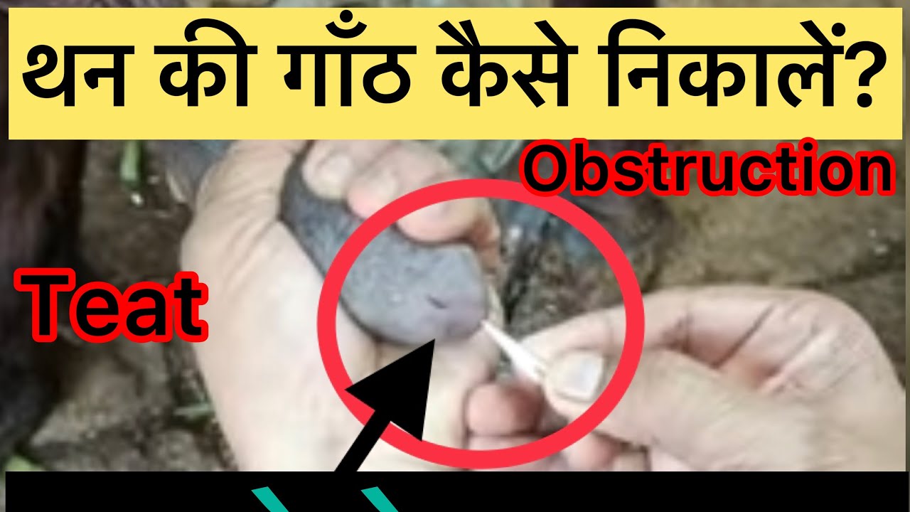 Teat fibrosis l Teat Obstruction l Dr Umar Khan - YouTube