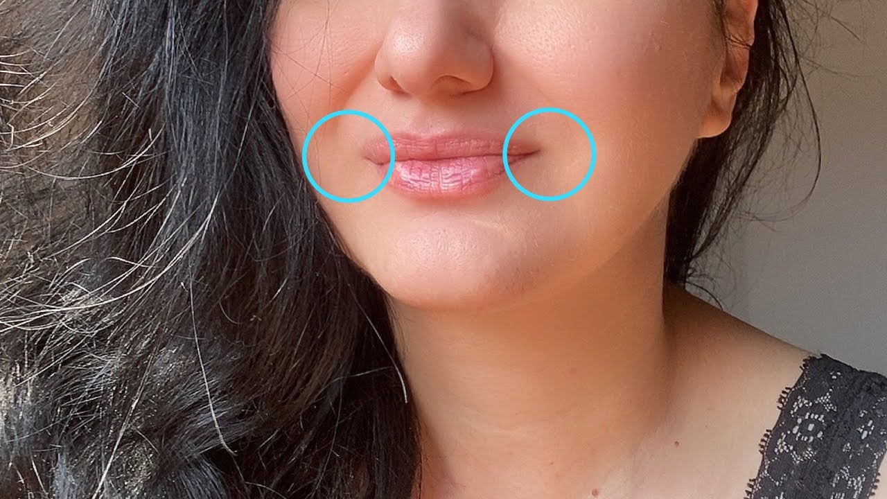 Droopy mouth. 7 methods to prevent or correct - YouTube