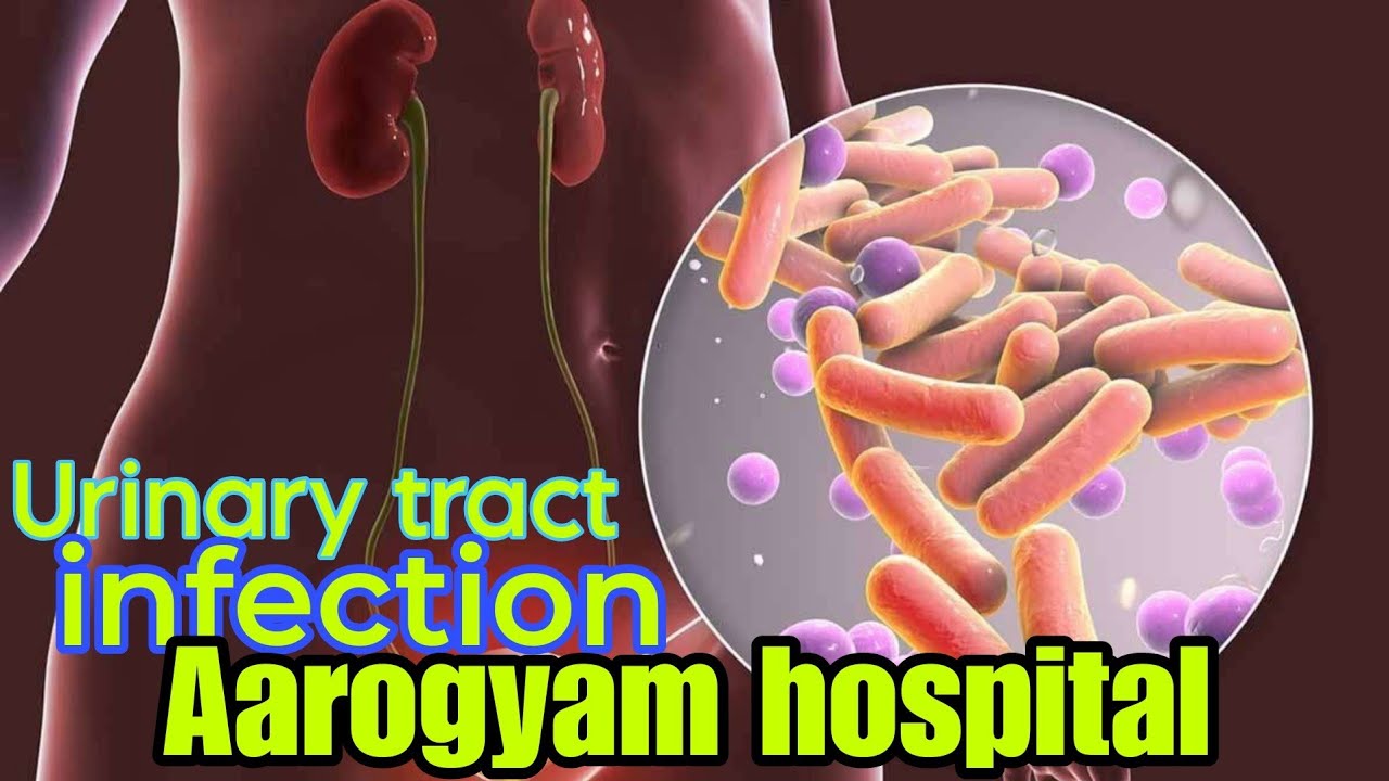 Severe Urinary Tract infection Treatment || Patient Feedback ...