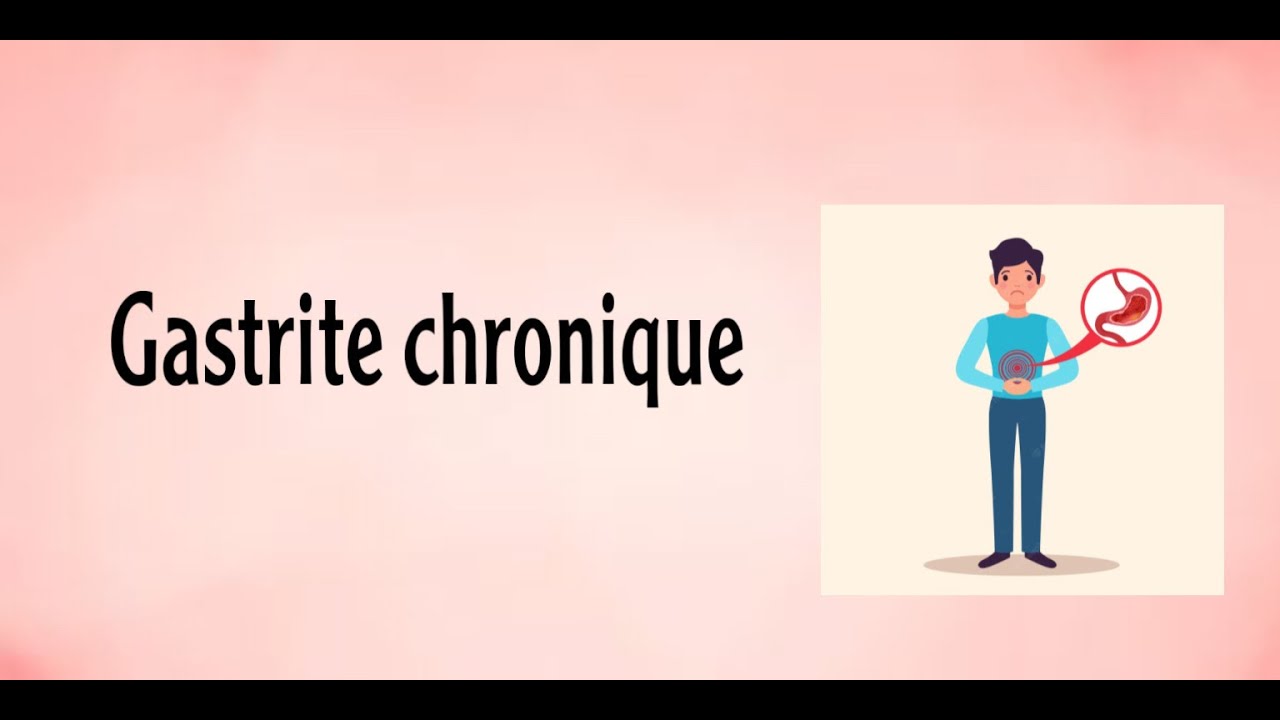 Gastrite chronique 💚 - YouTube