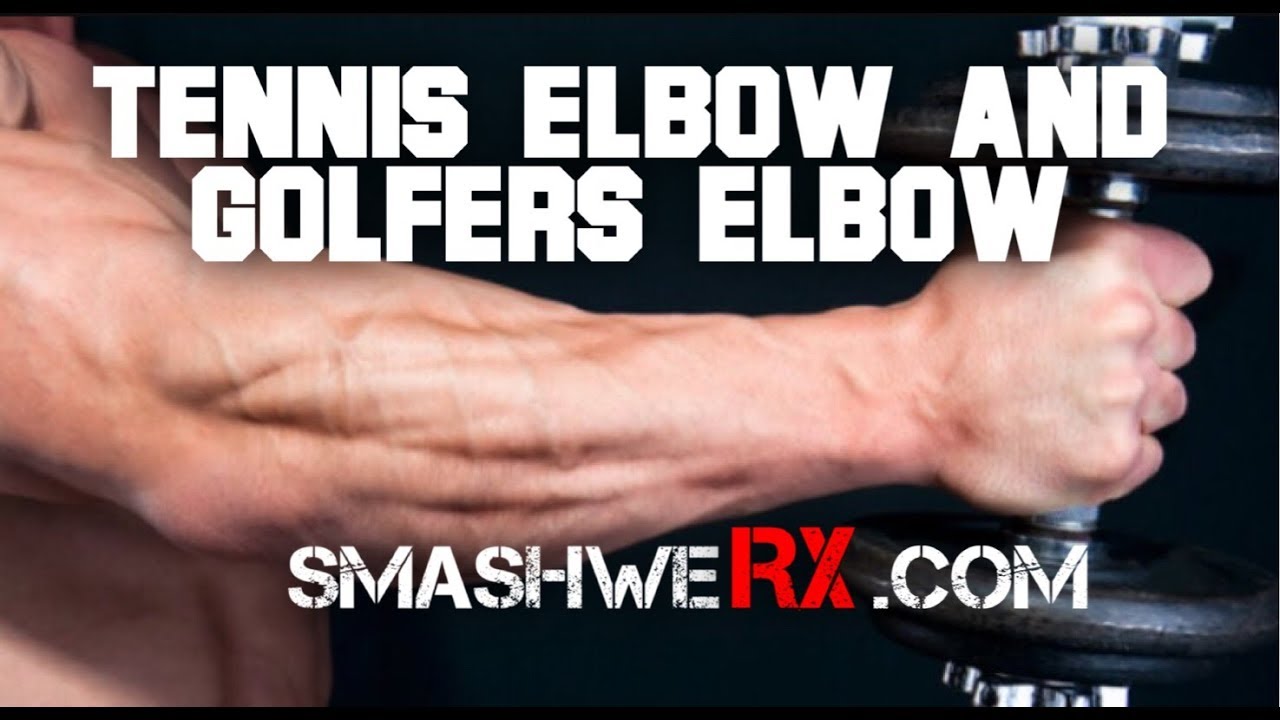 Tennis Elbow or Golfers Elbow? Knock it Out | Trevor Bachmeyer ...