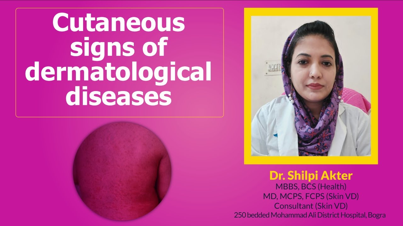 Dermatology Practice Workshop Cutaneous signs of Dermatological ...