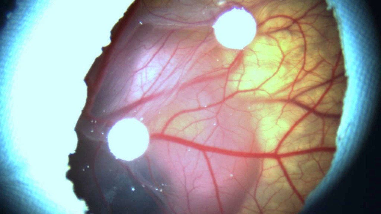 Membrana Alantoide UFC - YouTube