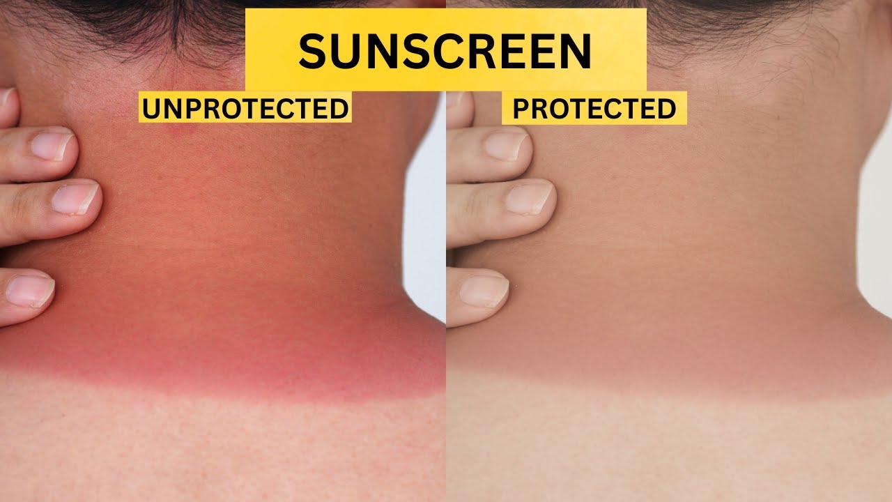 Sunscreen 101: Protect Your Skin Like a Pro - YouTube