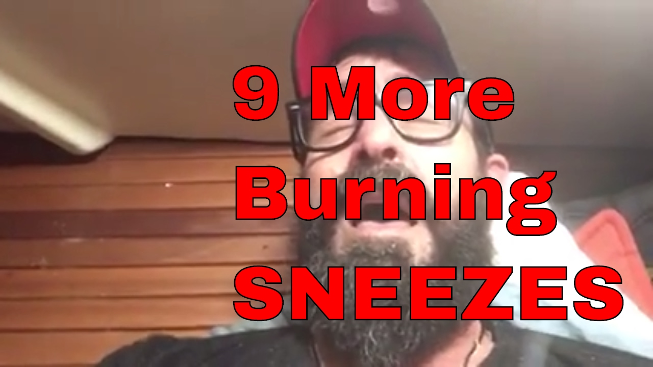 9 More Burning Sneezes Sneezing - YouTube