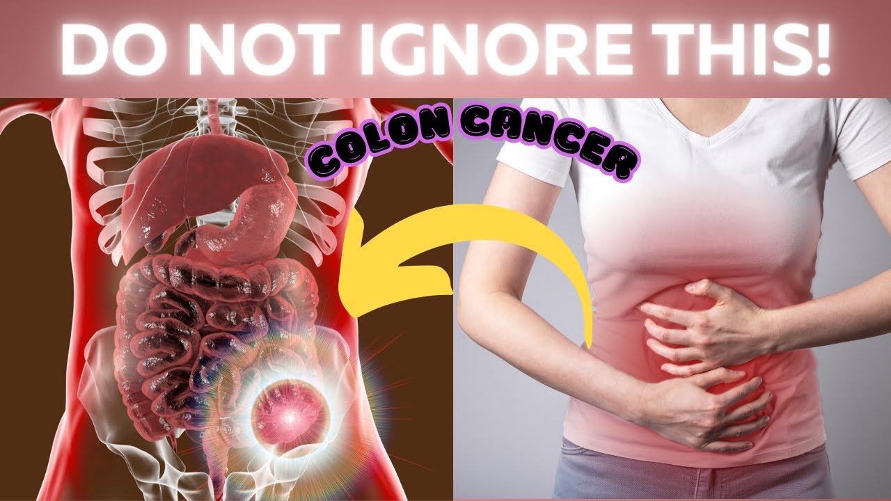 Early Signs Of Colon Cancer you should never ignore - YouTube