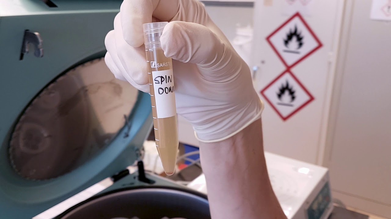 Step 3 - Visual reading of spin down analysis - YouTube