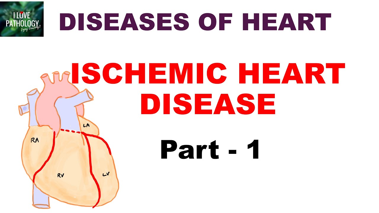 ISCHEMIC HEART DISEASE | part1 | Risk factors, Pathogenesis and ...