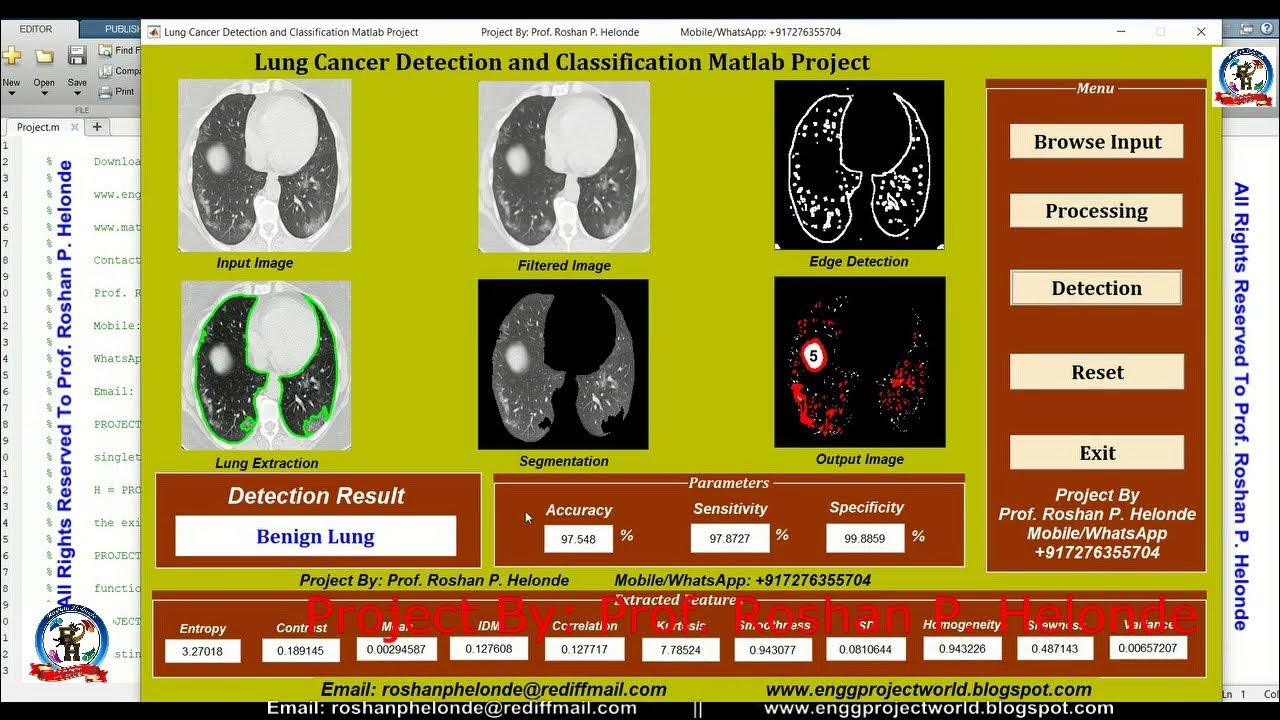 Early Lung Cancer Detection Using Image Processing Lung Cancer