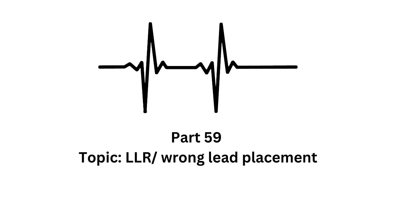 Part 59 Topic: LLR/ wrong lead placement - YouTube