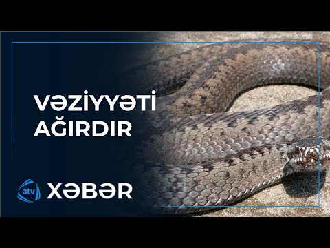 Goranboyda 75 yaşlı qadını ilan sancdı