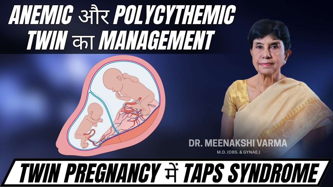 Twin Pregnancy में TAPS Syndrome क्या होता है ? Anemic और Polycythemic ...