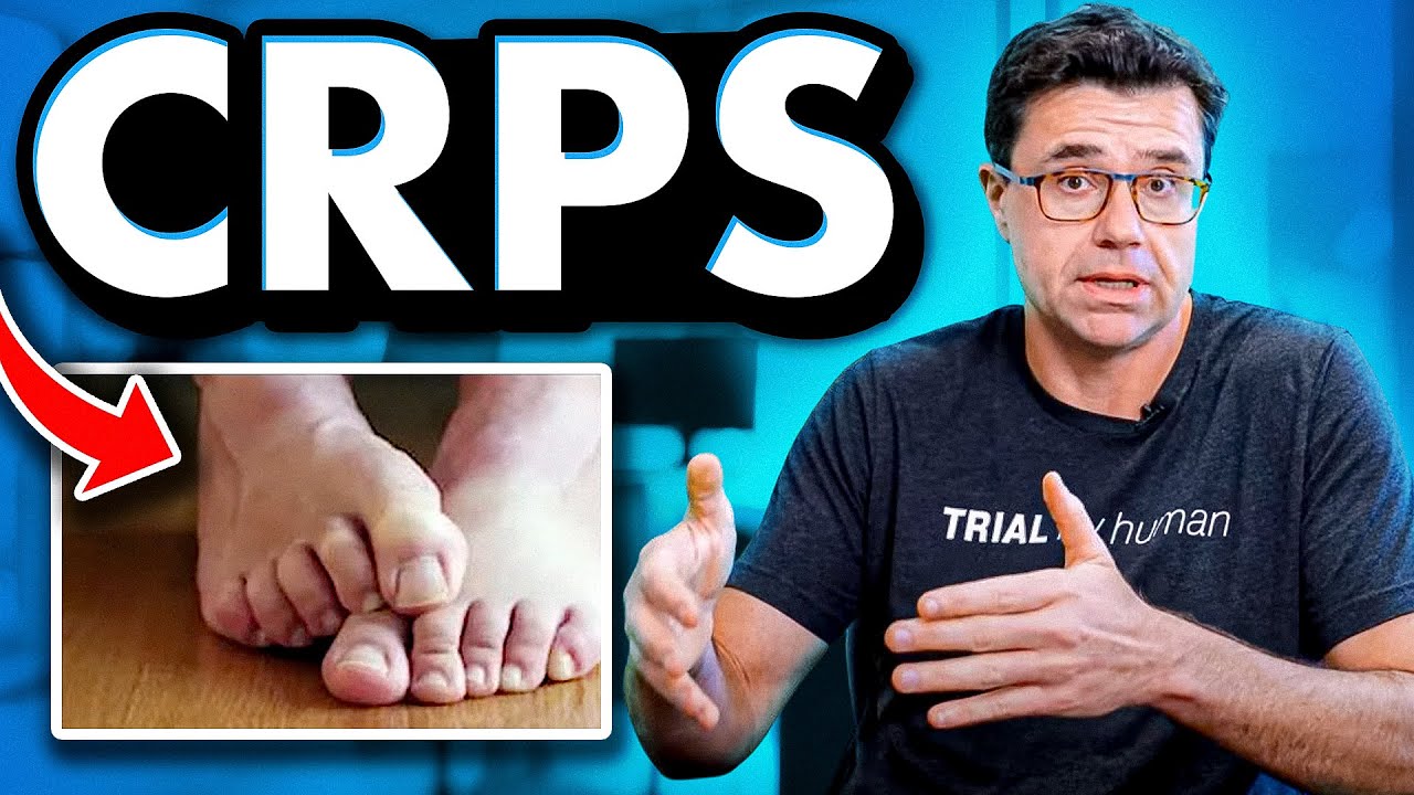 Inside a CRPS Trial - YouTube
