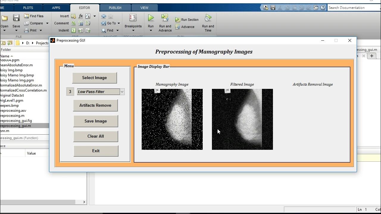 MATLAB code of Noise and Artifacts removal from Mammogram Images - YouTube