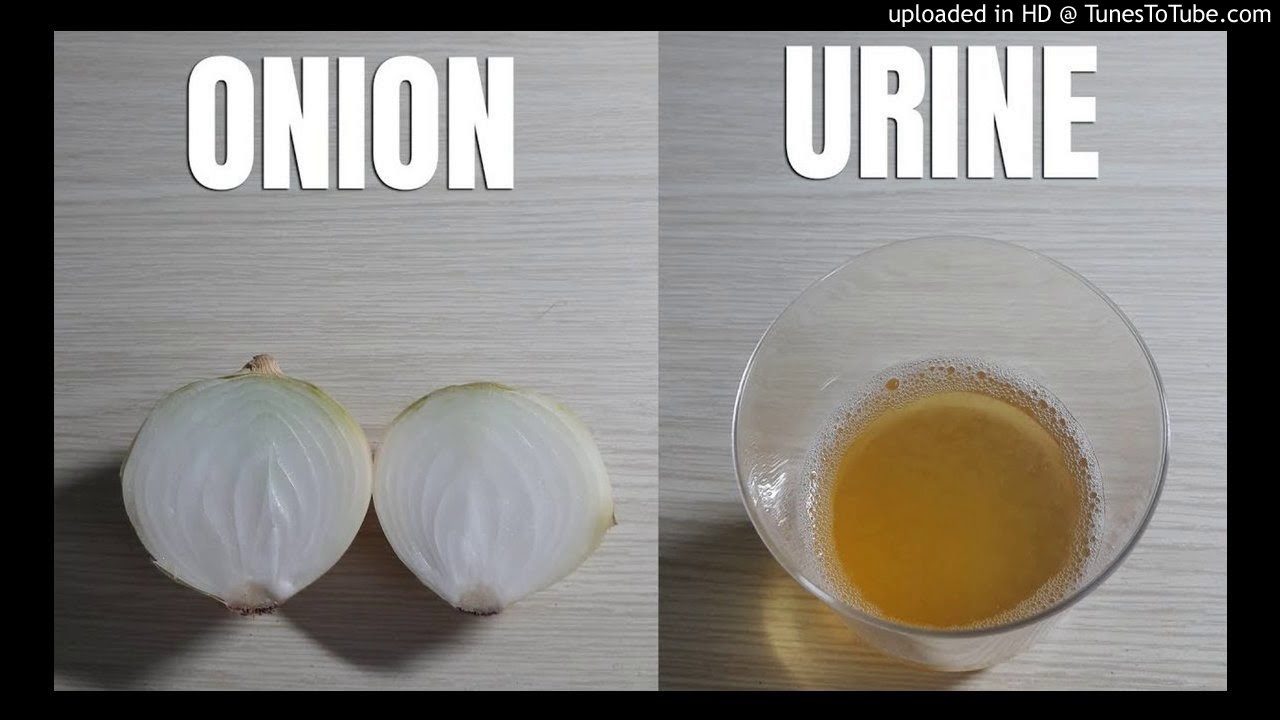 Uko wapima ko umuntu atwite wifashishije igitunguru - YouTube