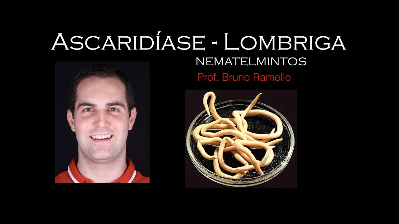 Verminoses - Ascaridíase ou Lombriga - YouTube