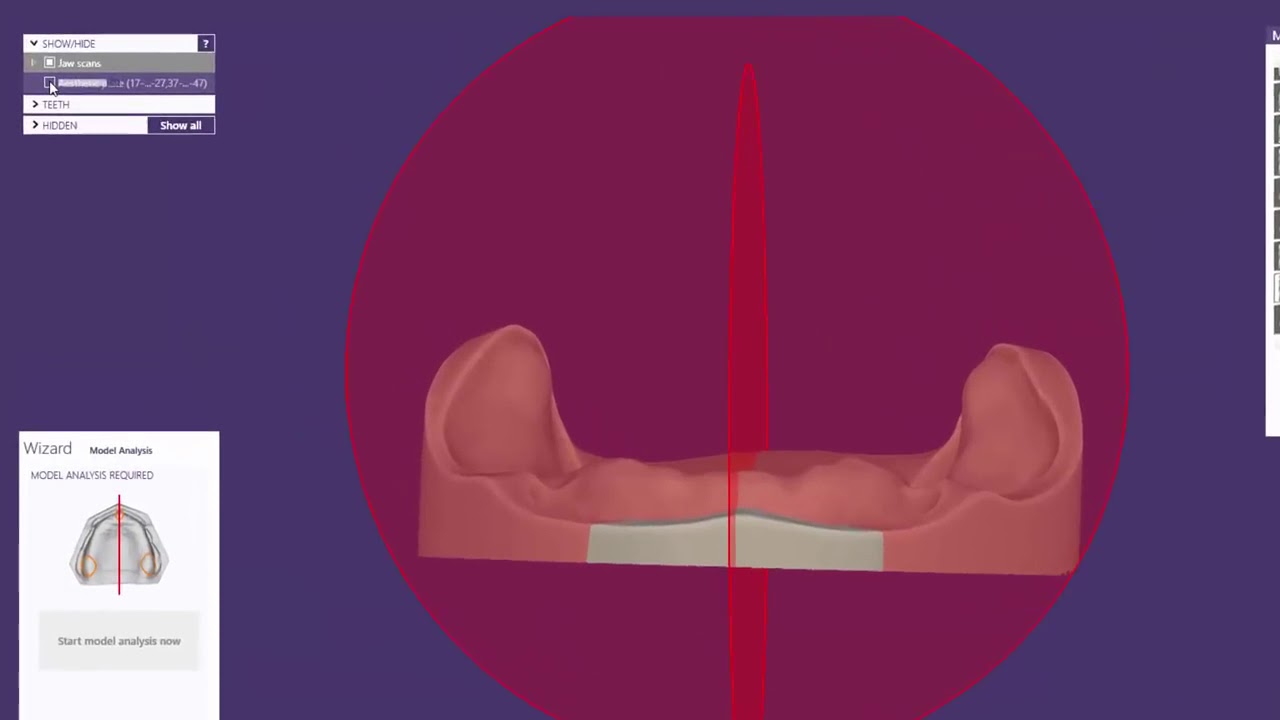 exocad Video Tutorial Full Denture Design - YouTube