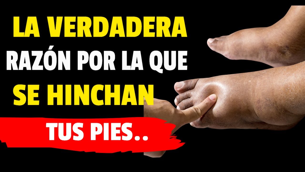 Por Qué se HINCHAN los PIES: La Razón Que NADIE te Dice - YouTube