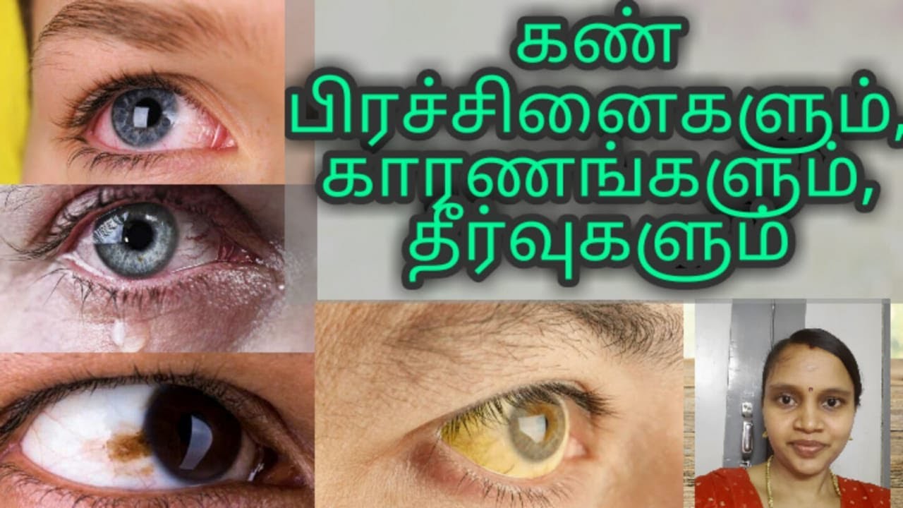 Eye problems|| Symptoms|| Solutions|| Children and Adults ...