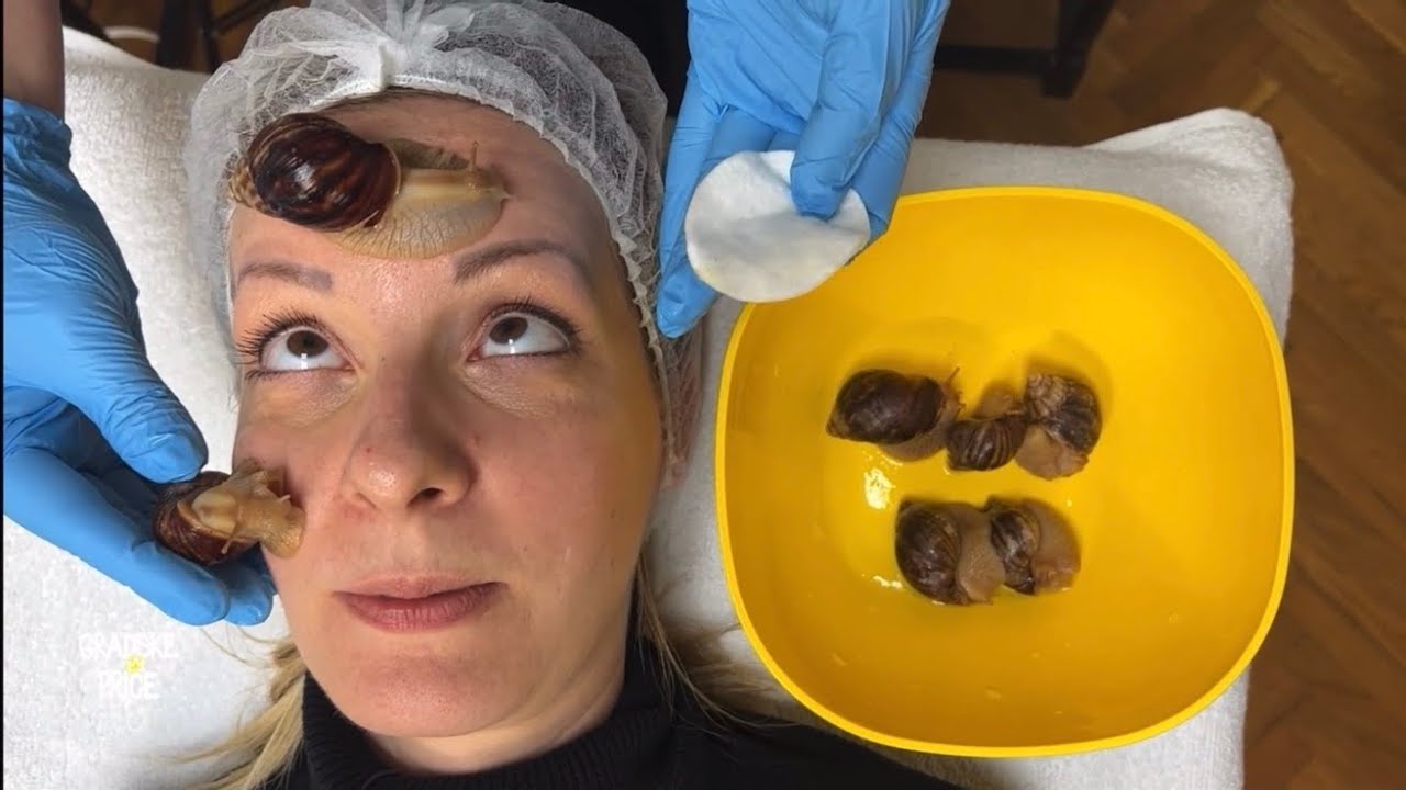 Puzevi za lice, pijavice za vene i jestivi crvi ("Gradske price", Una ...