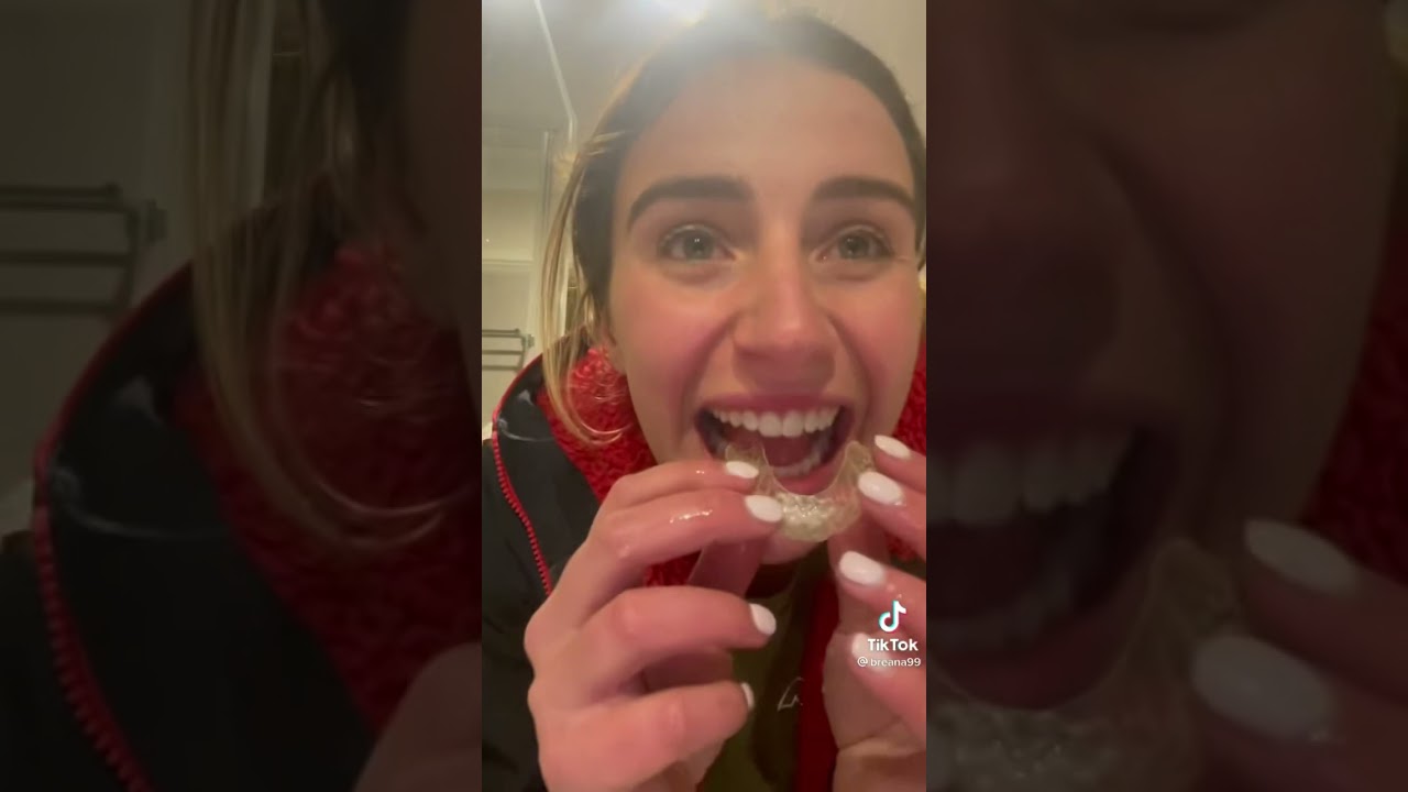 Bloody teeth in braces - YouTube
