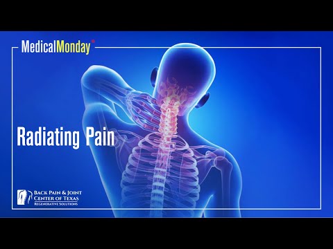 Medical Monday: Radiating Pain Edition - YouTube