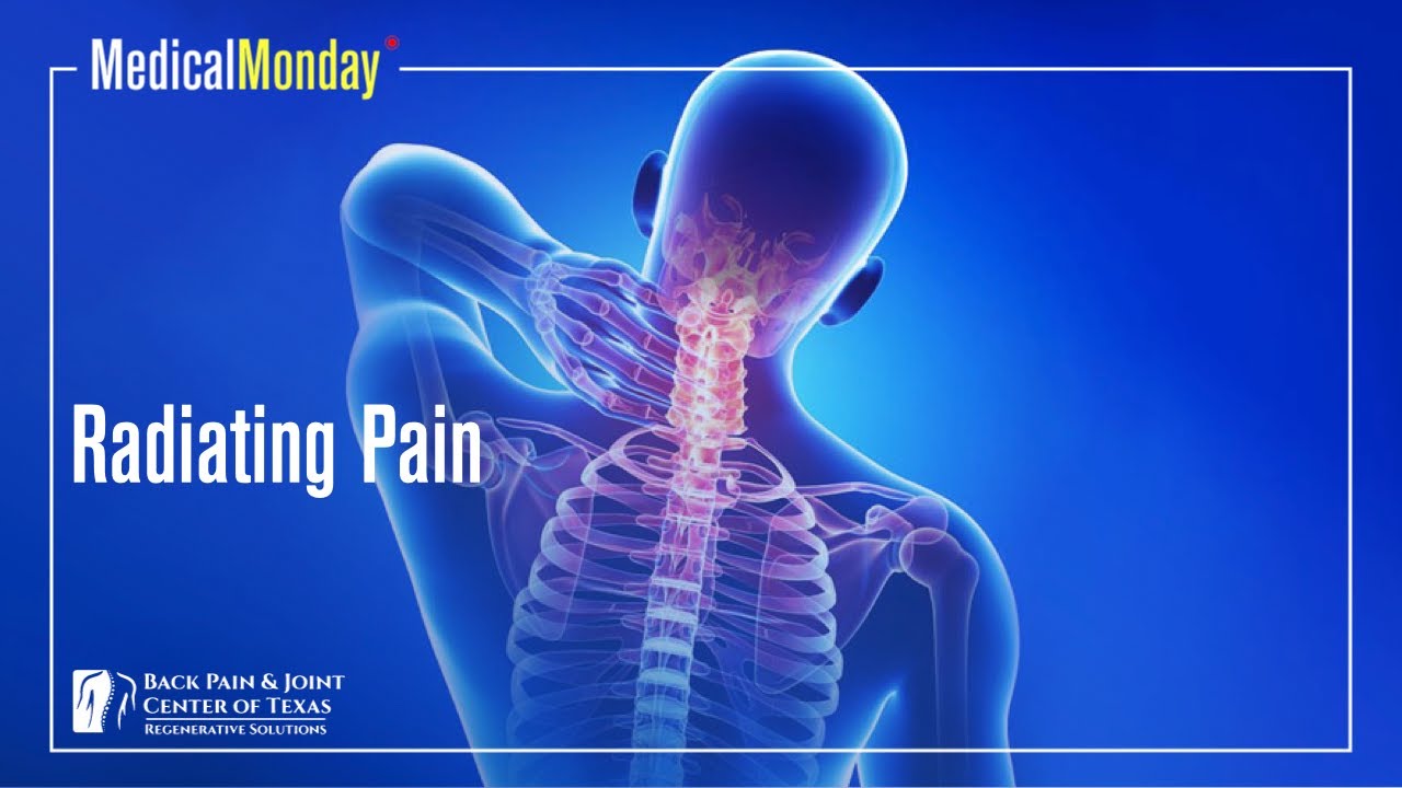 Medical Monday | Radiating Pain Edition - YouTube