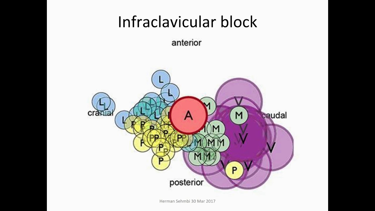 Upper limb anatomy for Ultrasound Guided Nerve Blocks part 2 - YouTube